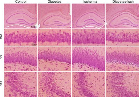 Mouse Hippocampus Histology