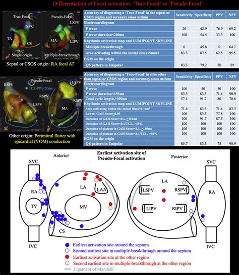 Differentiating Atrial Tachycardias With Centrifugal Activation Lessons From High Resolution