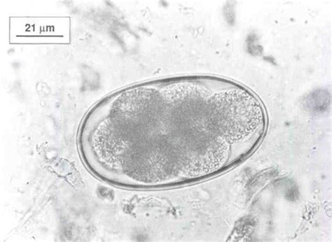 What Is This Organism Parasites Pseudoparasites And Parasite Eggs