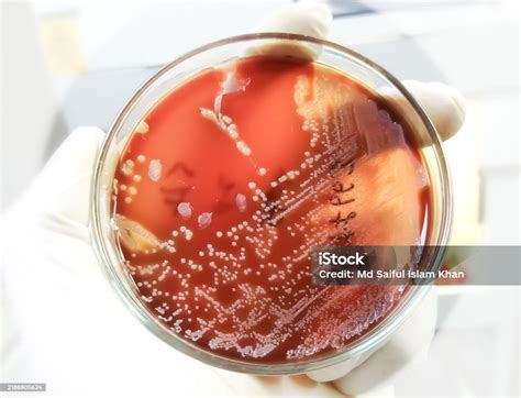 Staphylococcus Aureus Grampositive To Gramvariable Nonmotile Coccus Beta Hemolysis Saprotrophic