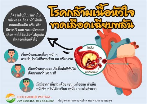 ภาวะกล้ามเนื้อหัวใจขาดเล ชิตชัยคลินิกการแพทย์แผนไทย พัทยา