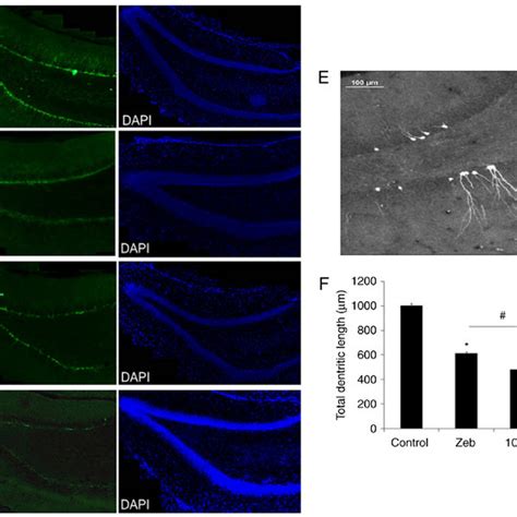 Dendrite Length Of Newly Formed Neurons Decreases Following Download Scientific Diagram