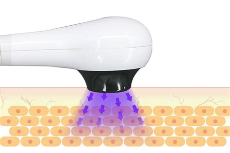 Rf 스킨 케어 얼굴 리프트 뷰티 악기 의 고품질 Rf 스킨 케어 얼굴 리프트 뷰티 악기