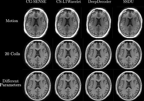 Here We Show Axial Brain Slice Reconstructions From Three Different Download Scientific Diagram
