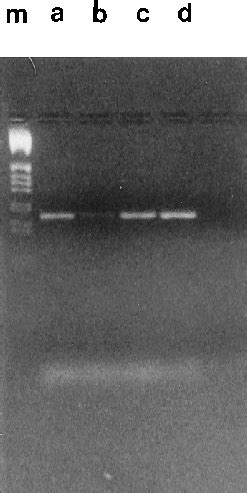 Presence Of Globin MRNA In Different Tissues Of Aphrodite MRNA Was Download Scientific