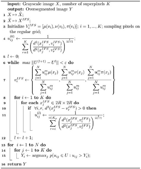 Superpixels Extraction By An Intuitionistic Fuzzy Clustering Algorithm
