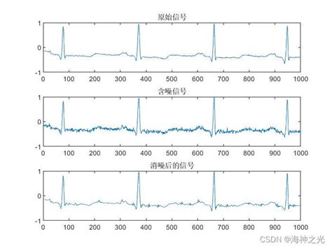 【心电信号】基于matlab小波阙值心电信号去噪【含matlab源码 2188期】 小波阈值降噪matlab csdn博客