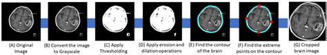 Preprocessing Steps For Cropping The Brain Area From Mri Images Download Scientific Diagram