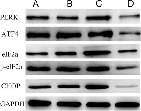 The Picture Of Perk Atf4 Eif2a P Eif2a And Chop Proteins In The