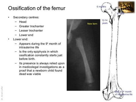 Imaging Anatomy Dislocation Of The Hip Joint