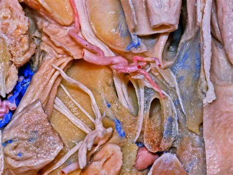 Inferior View Of Infratemporal Fossa Neuroanatomy The Neurosurgical Atlas