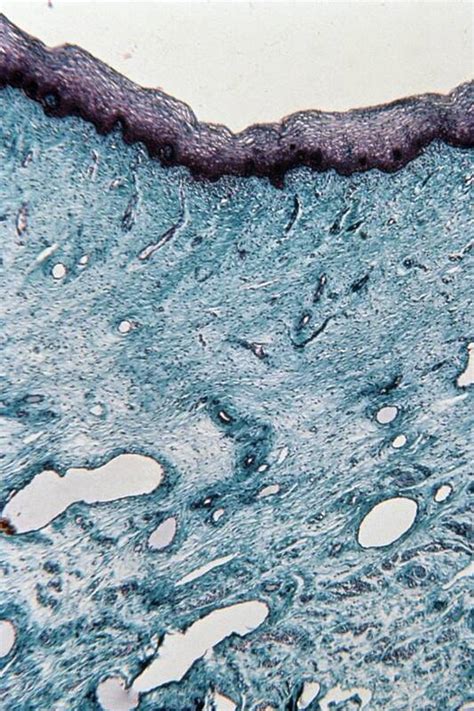 Vaginal Mucosa Light Micrograph Art Print By Science Photo Library Science Photo Gallery