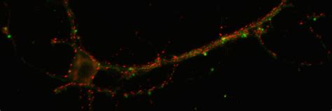 Research Doyle Lab Neuroscience Research Institute Uc Santa Barbara