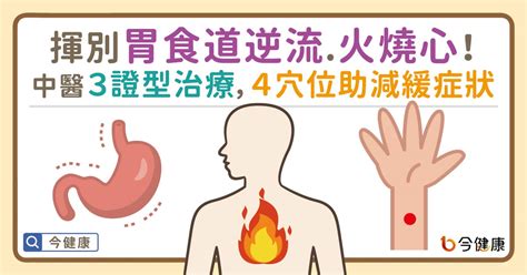 揮別胃食道逆流、火燒心！中醫3證型治療，4穴位助減緩症狀！