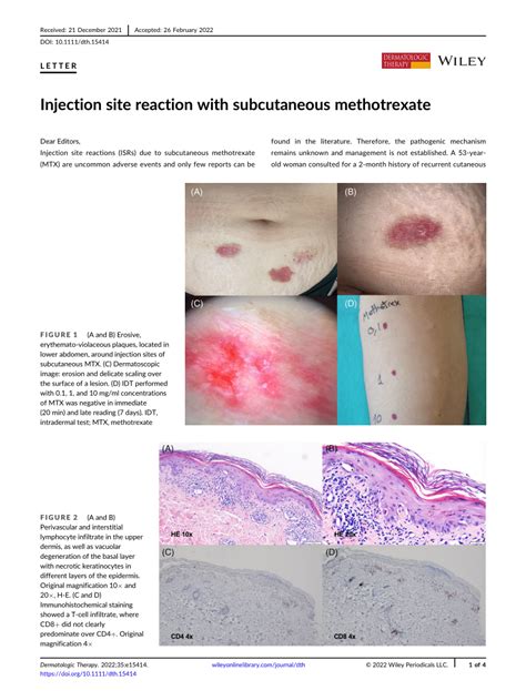 Injection Site Reaction With Subcutaneous Methotrexate