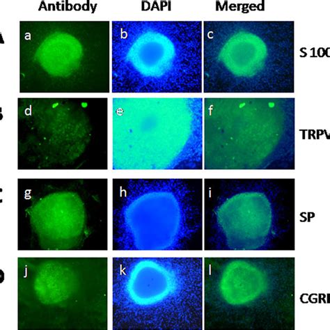 Qualification Of Drg And Staining Of Trpv1 Sp And Cgrp In Drg Download Scientific Diagram