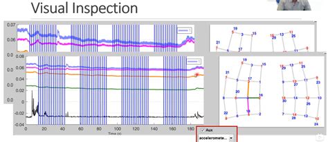 近红外数据处理 2hmer2 Fnirs 基线校正 Csdn博客 近红外数据处理 2hmer2 Fnirs 基线校正 Csdn博客