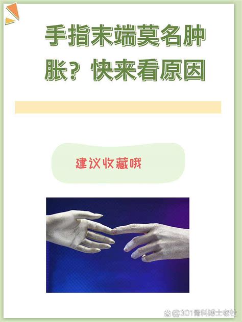 手指末端莫名肿胀？