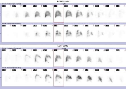 Image Radiopaedia Org