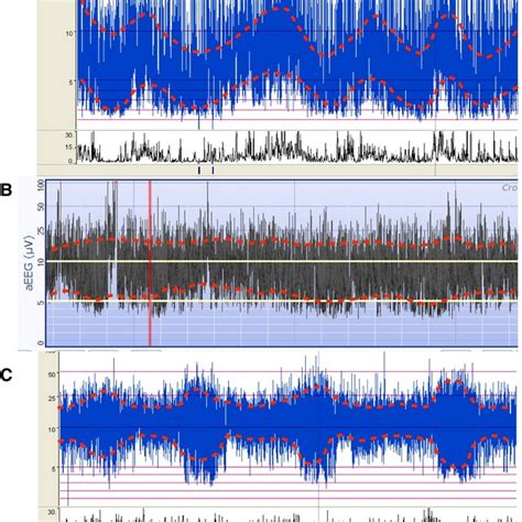 Differences Between Term And Preterm Aeeg In Health And Disease Panel Download Scientific