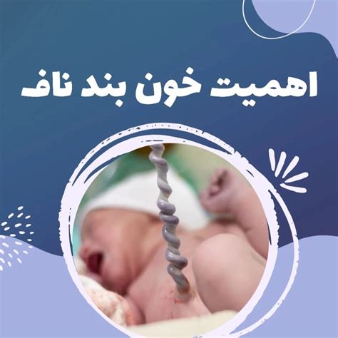 اگر می‌خواهید خون بند ناف نوزاد رو ذخیره کنید، باید قبل از زایمان با