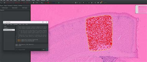 qupath stardist extension hande nuclei counting improvement image