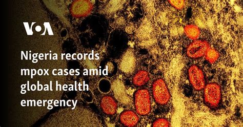 Nigeria Records Mpox Cases Amid Global Health Emergency