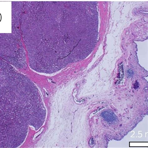 A Transperitoneal Laparoscopic Incision Of Peritoneum And Bladder Download Scientific Diagram