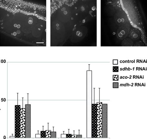 Fig S Down Regulation Of Additional Tricarboxylic Acid TCA Cycle Download Scientific