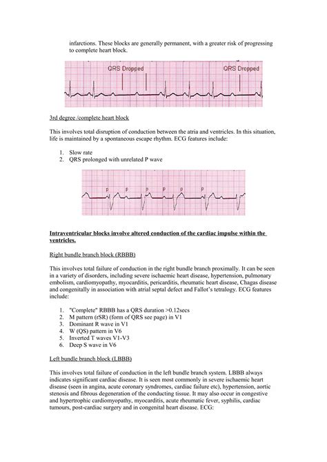 Beginners Guide For ECG Interpretation DOC Heart And Cardiovascular Diseases Diseases And