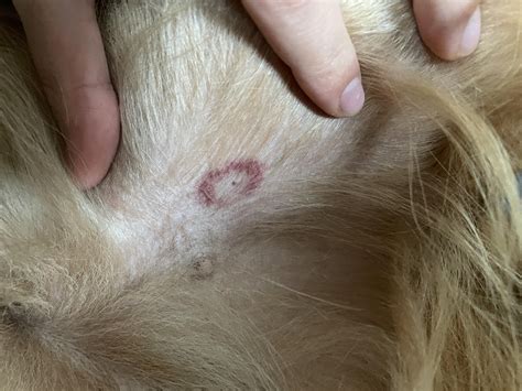 How Long Does A Tick Need To Bite Tp Transmit Lyme Rlyme