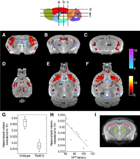 High Resolution Structural Mri A F Results From Structural