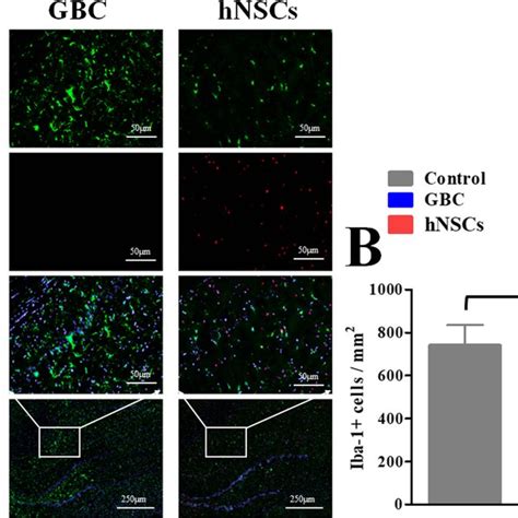 The Recruitment Of Microglia In The Hippocampus And Tracking Of Download Scientific Diagram