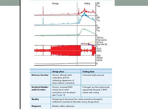 Urology Neurogenic Bladder Urodynamics Pptx
