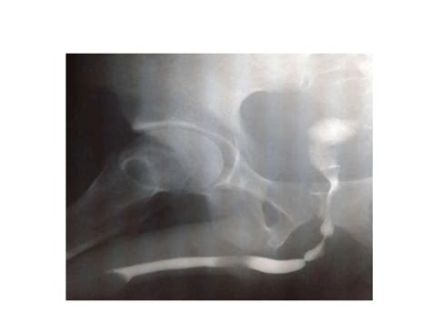 Retrograde Urethrogram For Urology Residents Pptx