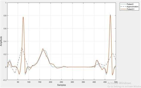 Work Space For Ecg Signal Denoiser Figure 8 Noised And Denoised Download Scientific Diagram