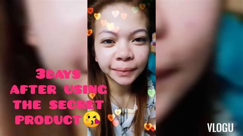 How To Remove Pimples YouTube