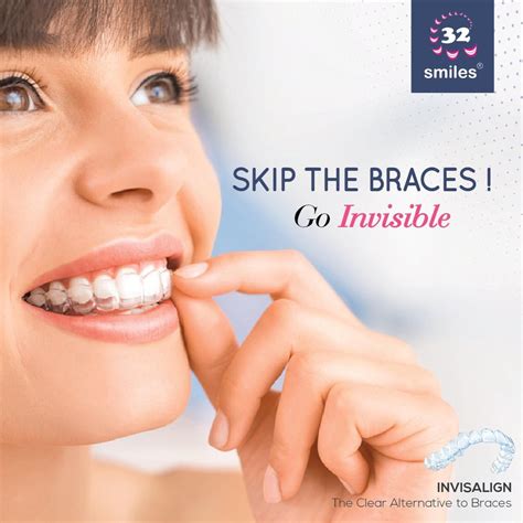 Correcting The Position Of Teeth With The Aesthetic Invisalign Splint