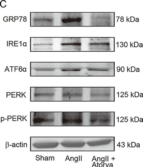 Atf6 Fusion Protein Ag29781 Proteintech