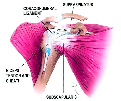 Rotator Cuff Evaluation With Us And Mr Imaging Radiographics