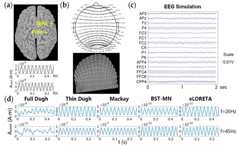 Robust Evaluation And Comparison Of Eeg Source Localization Algorithms