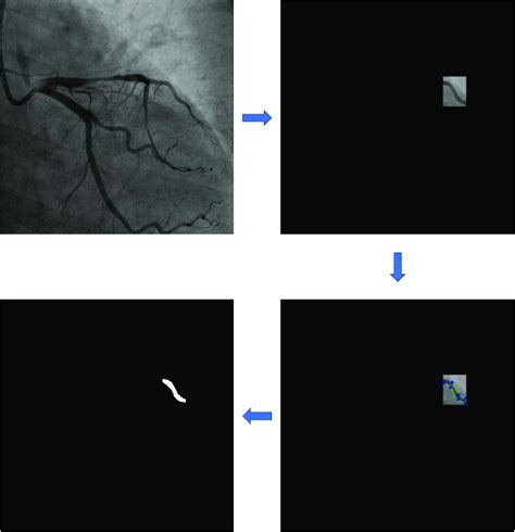 Schematic Diagram Of Segmentation Of Vascular Segments Download