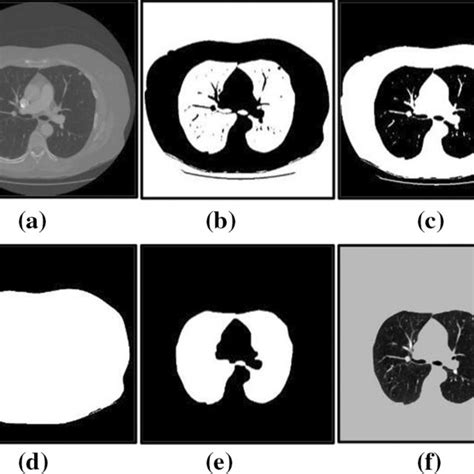 Lung Segmentation A A Slice Of A Lung Image B First Mask C Regions Download Scientific