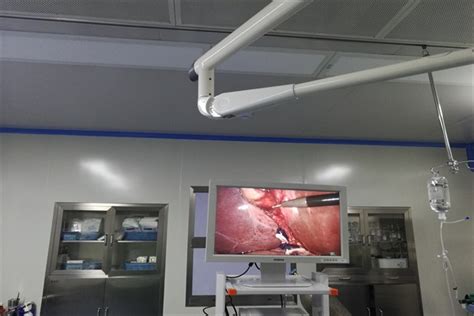 内窥镜技术应用的优缺点有哪些 医用DR 国产DR厂家 平板DR 医用监视器 摄像机 冷光源 灌注泵 气腹机