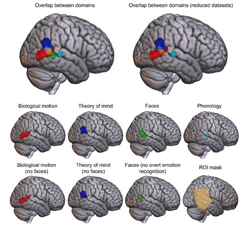 Activation Likelihood Estimation Maps For The Four Domains With Download Scientific Diagram