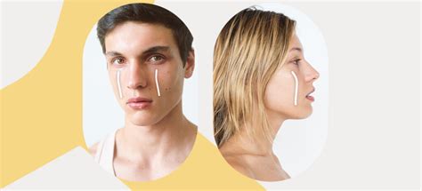 Sunken Or Flat Cheekbones What Could Be Done About Them Ach