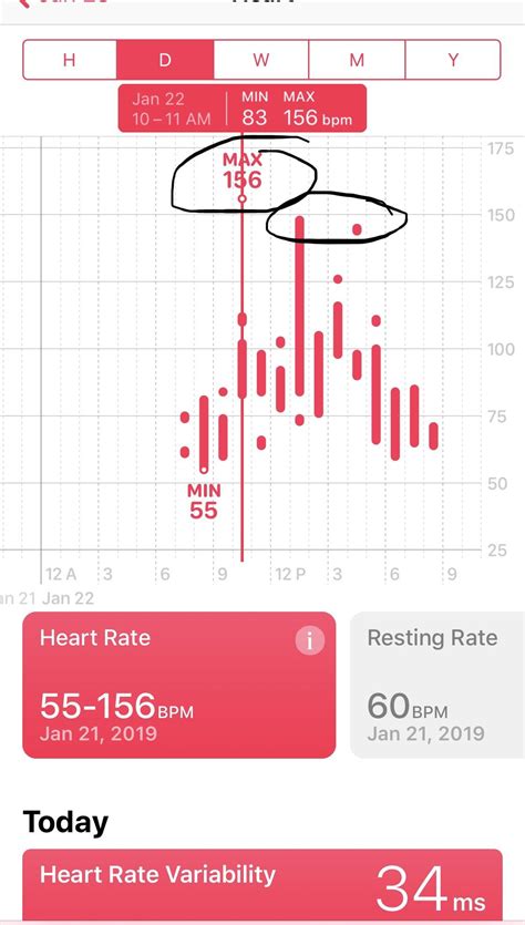 Heart Monitor Chart What Is Heart Rate Flowtime