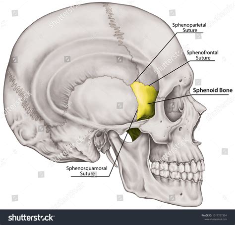 Sphenoparietal Suture