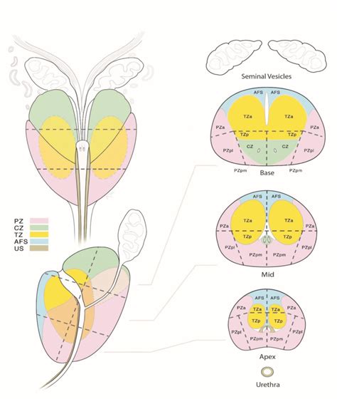 Acr Pi Rads Appunti Di Un Giovane Radiologo