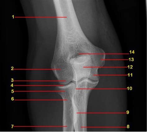 Posterior Elbow Xray Flashcards Quizlet